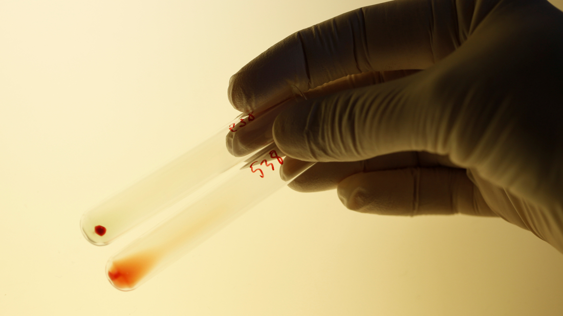 ‘Gwada negative’: French scientists discover rarest blood | AnewZ